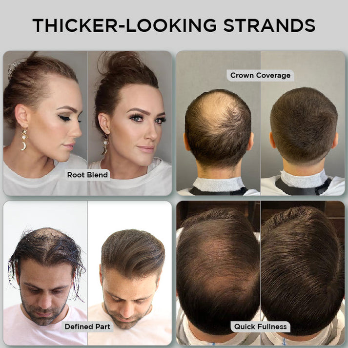 THICK FIBER Hair Building Fibers – Hair Loss Concealer for Thinning ...