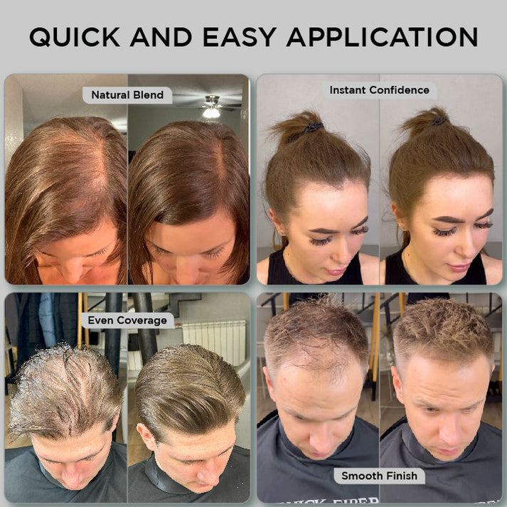 THICK FIBER Hair Building Fibers – Hair Loss Concealer for Thinning ...